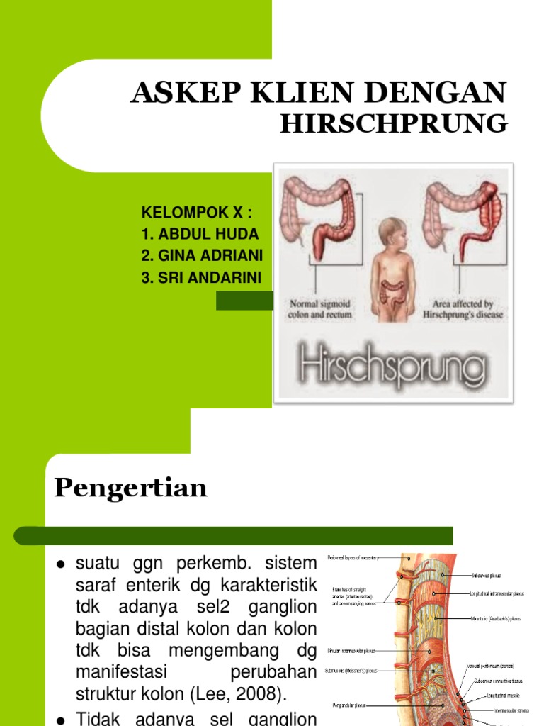 Askep Hisprung | PDF
