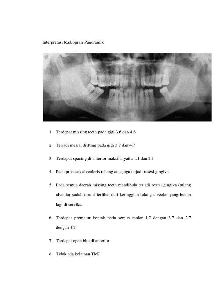 Interpretasi Radiografi Panoramik | PDF