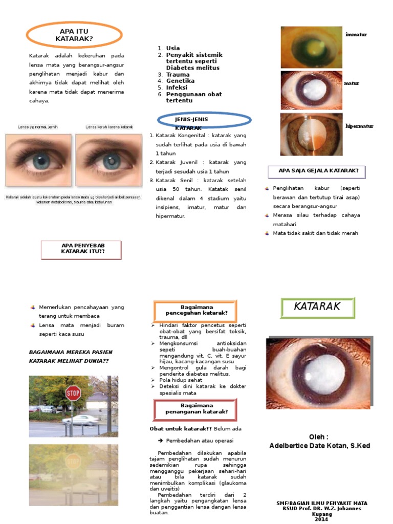 Leaflet Katarak | PDF