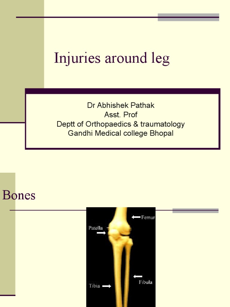 Injuries Around Leg: DR Abhishek Pathak Asst. Prof Deptt of ...