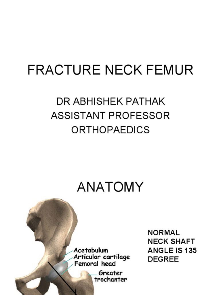Fracture Neck Femur | PDF | Hip | Human Anatomy