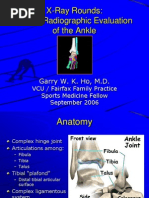 Posterior Tibial Tendon Insufficiency (PTTI) - Foot & Ankle ...