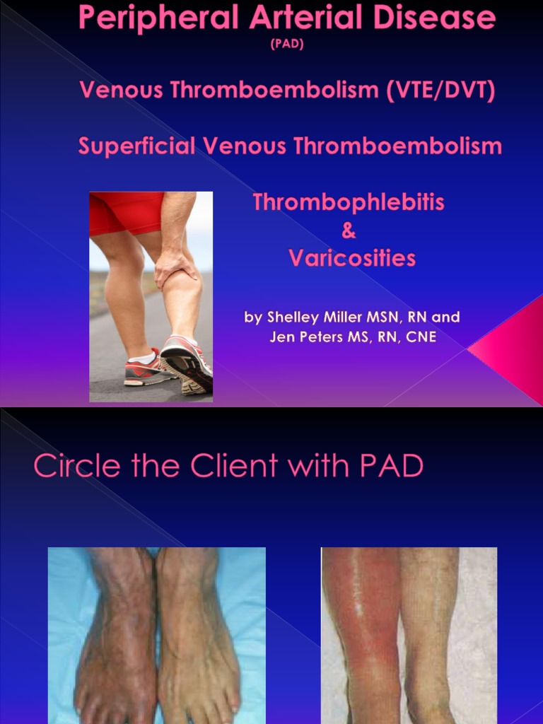 PAD vs DVT: Key Differences and Care | PDF | Thrombosis | Vein