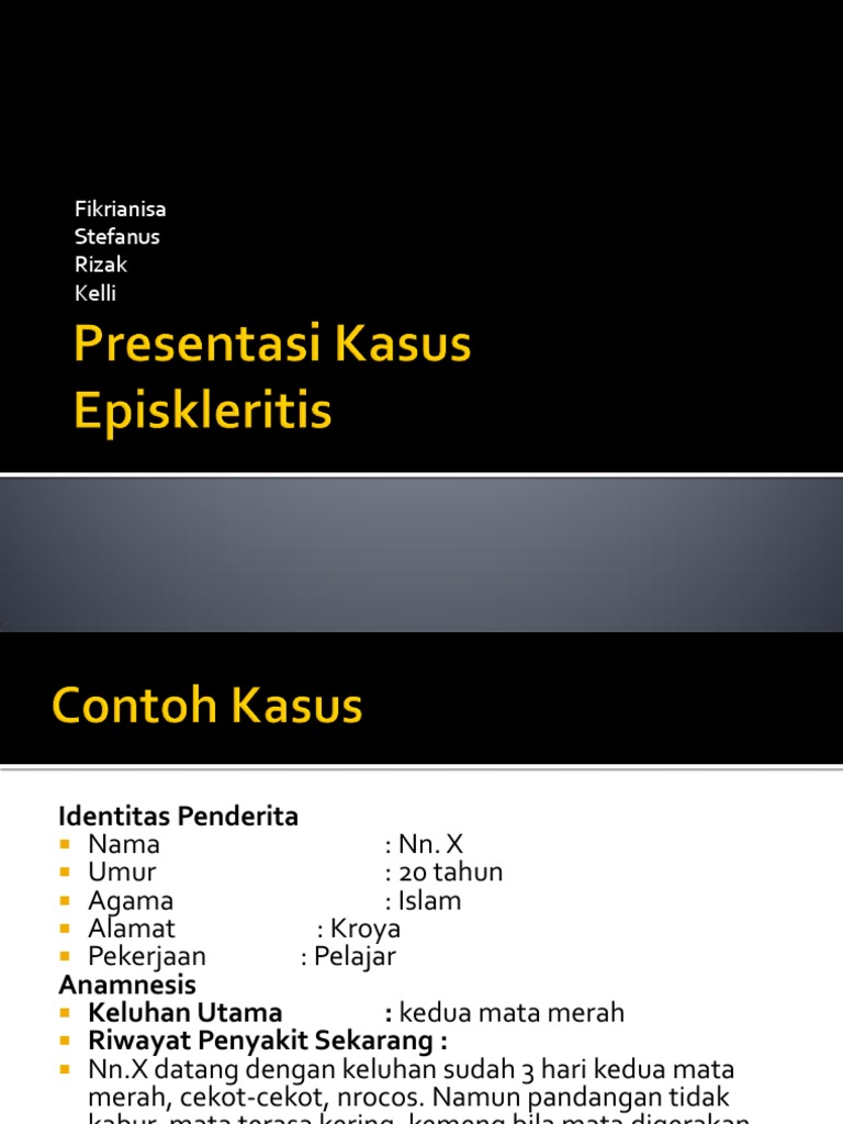 Presus Episkleritis | PDF