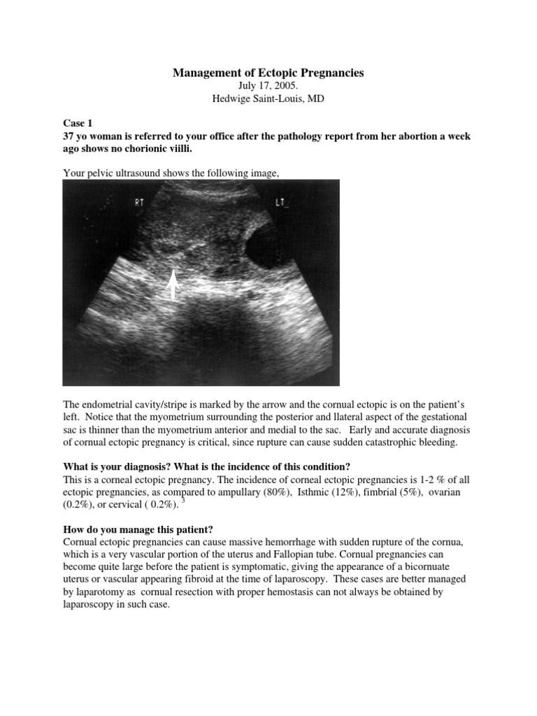 Management of Ectopic Pregnancy | Human Reproduction | Medical Specialties