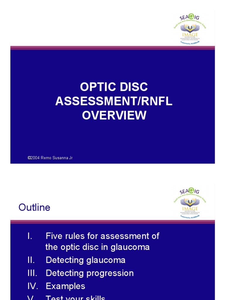 Optic Disc Assessment RNFL Overview | PDF
