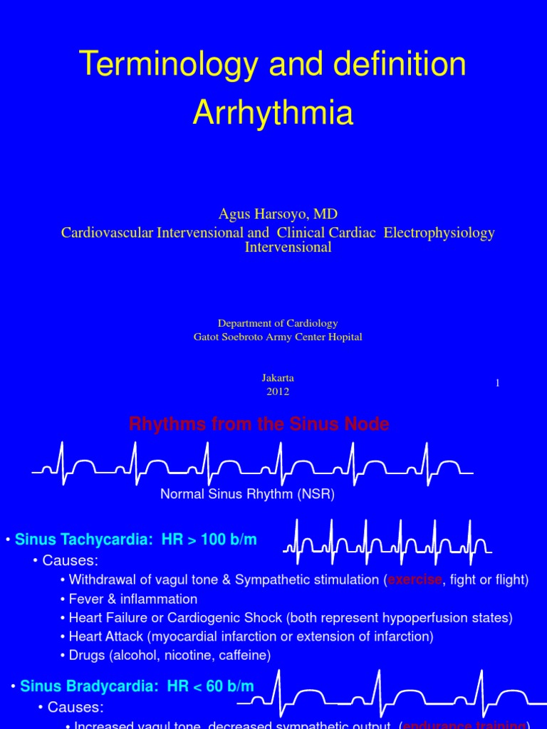 Arrhythmias | PDF | Cardiac Arrhythmia | Heart