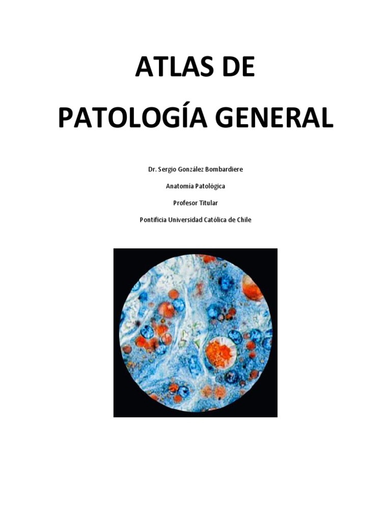 Atlas de Pato PUC | PDF | Neoplasias | Epitelio