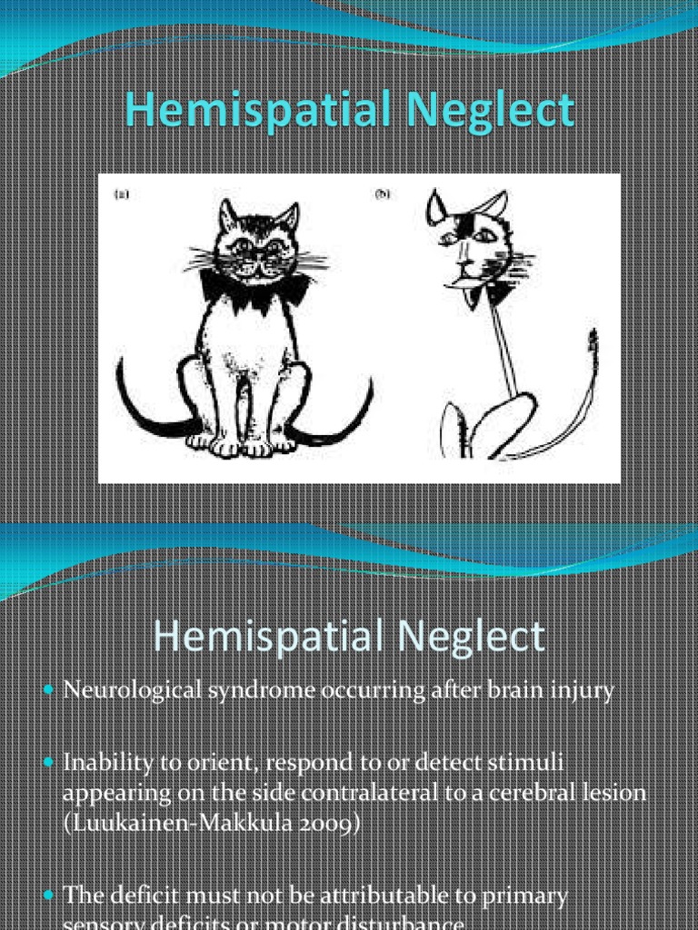 Hemispatial Neglect LDH | PDF | Attention | Mental Processes