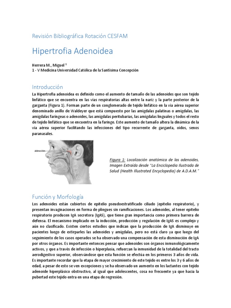 Revisión Bibliográfica Hipertrofia Adenoidea | PDF | Alergia | Virus