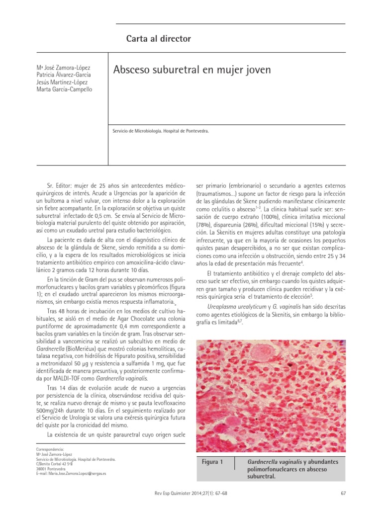 Absceso de glándula de Skene en mujer joven | PDF | Microbiología ...