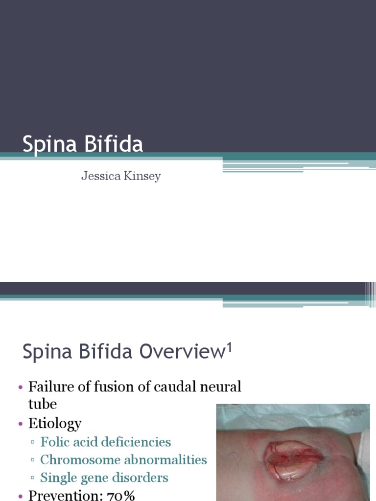 Spina Bifida | PDF | Folic Acid | Diet & Nutrition