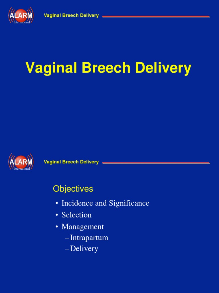Guidelines and Techniques for Vaginal Breech Delivery | PDF ...