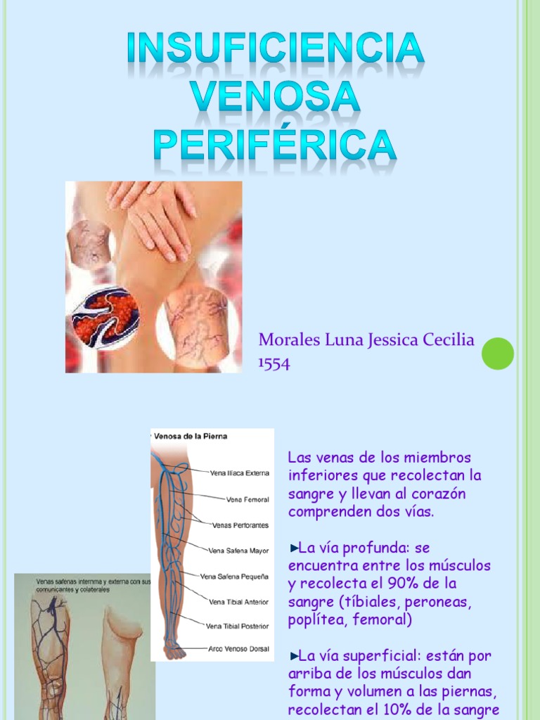 Anatomía, causas, síntomas y tratamiento de las varices | PDF | Venas ...