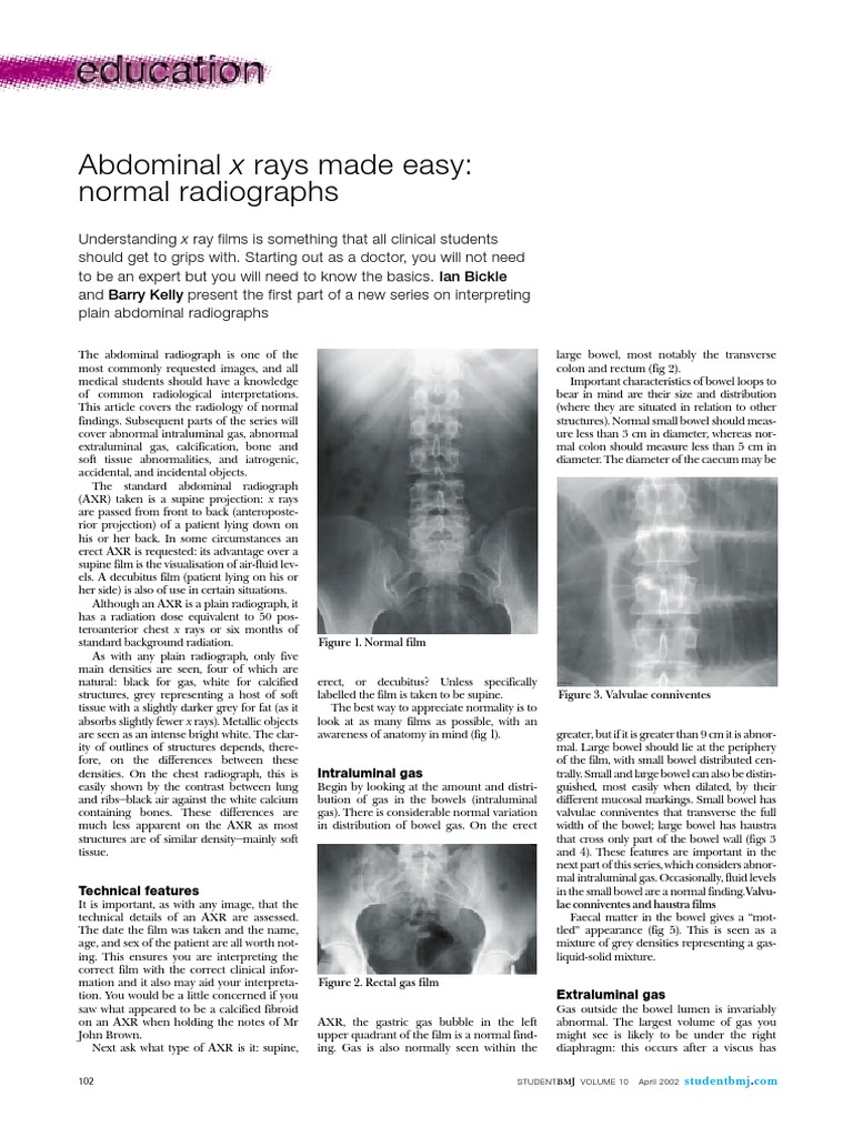 AXR Made Easy | PDF | Vertebral Column | Gastrointestinal Tract