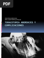 Lobectomia | PDF | Cirugía | Pulmón