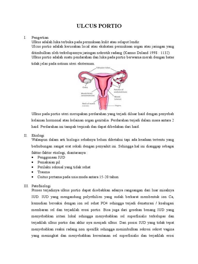 DIAGNOSING AND MANAGING CERVICAL ULCERS | PDF