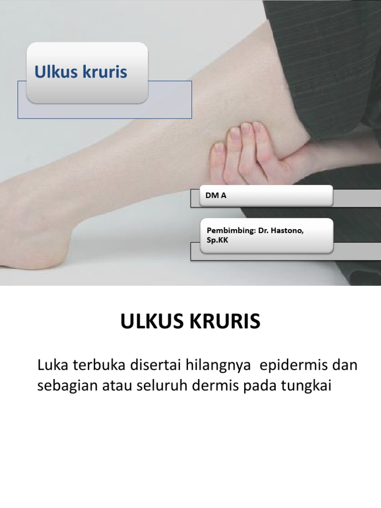 Pengertian dan Penanganan Ulkus Kruris | PDF