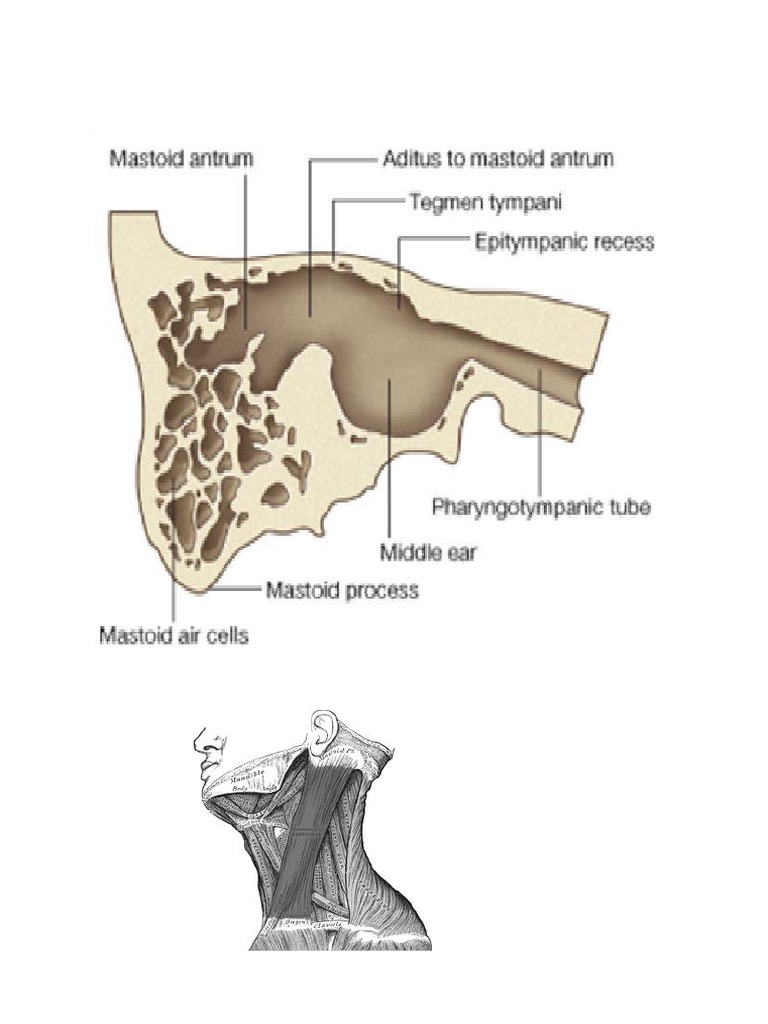 Patogenesis Abses Bezold | PDF