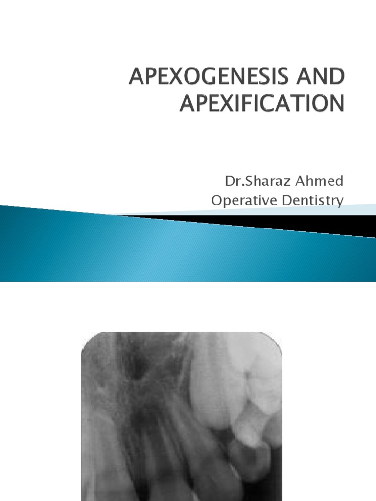 Apexification and Apexogenesis | Mouth | Health Sciences