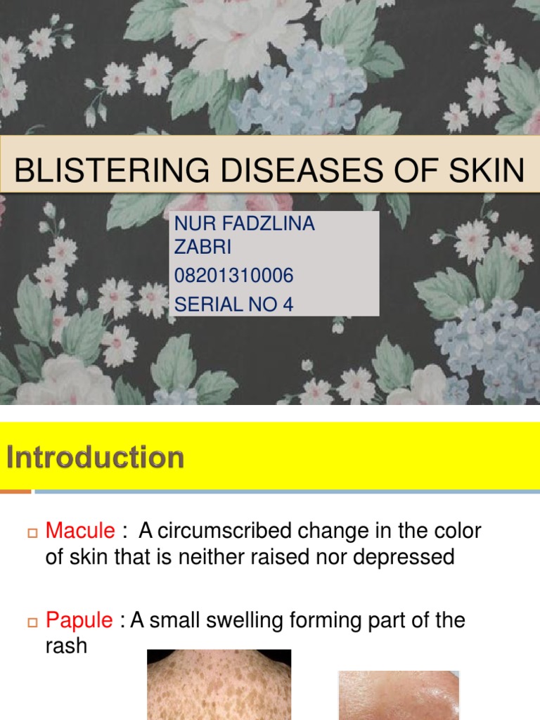 Blistering Diseases of Skin | PDF | Cutaneous Conditions | Medical ...