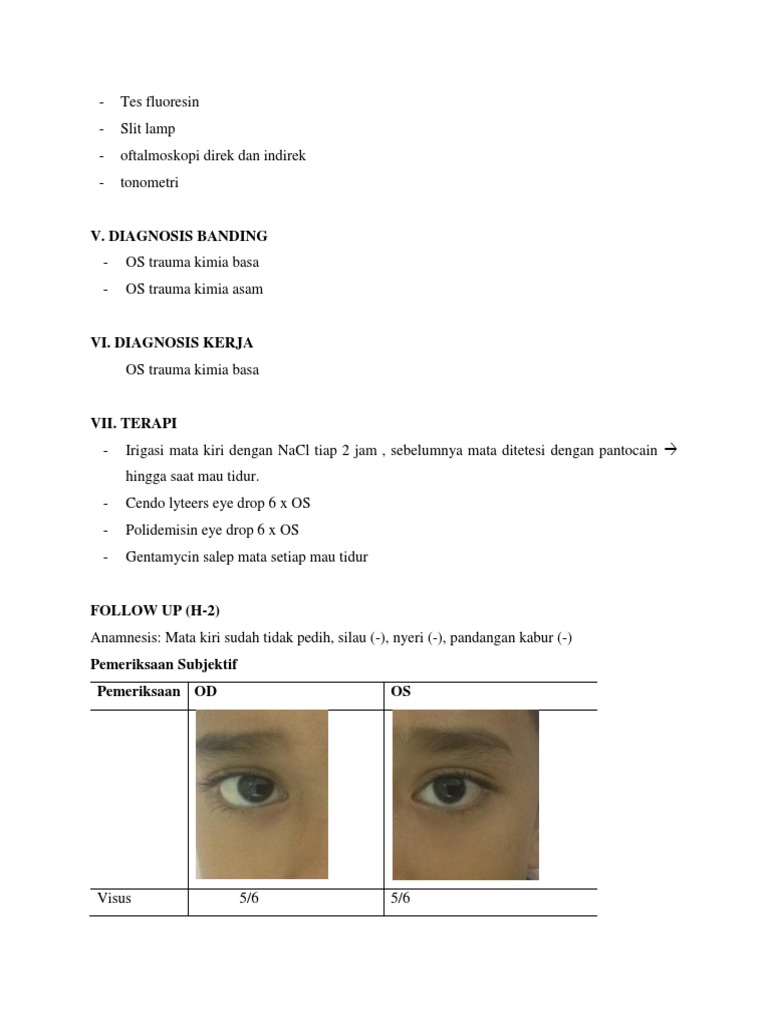 Diagnosis dan Terapi Lithiasis Mata | PDF