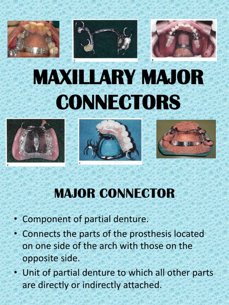 Maxillary Major Connectors | PDF | Dentures | Anatomical Terms Of Location