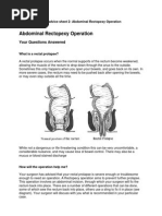 Hartmann's Procedure | PDF | Surgery | Colorectal Cancer