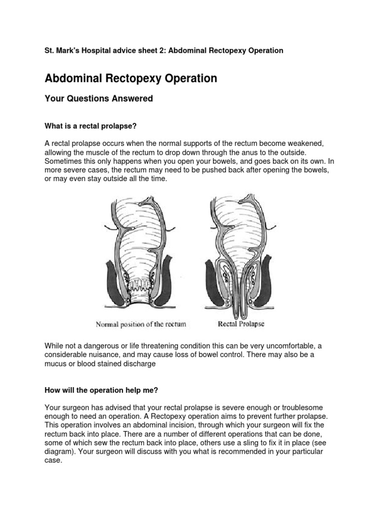 Rectopexy | Food And Drink | Food & Wine | Free 30-day Trial | Scribd
