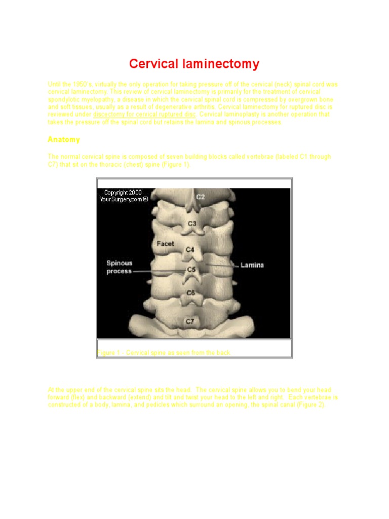 Cervical Laminectomy: Anatomy | PDF | Vertebra | Vertebral Column