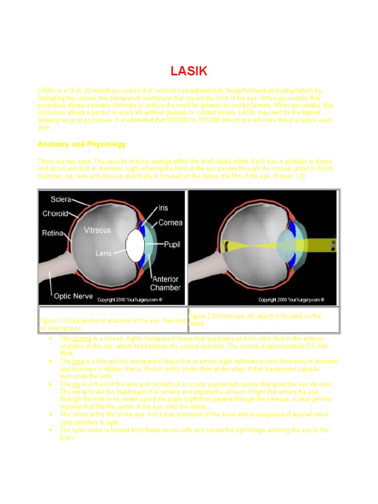 Lasik: Anatomy and Physiology | PDF | Cornea | Human Eye