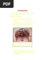 Normal Tonsil Size and Grading | PDF | Infection | Immunology