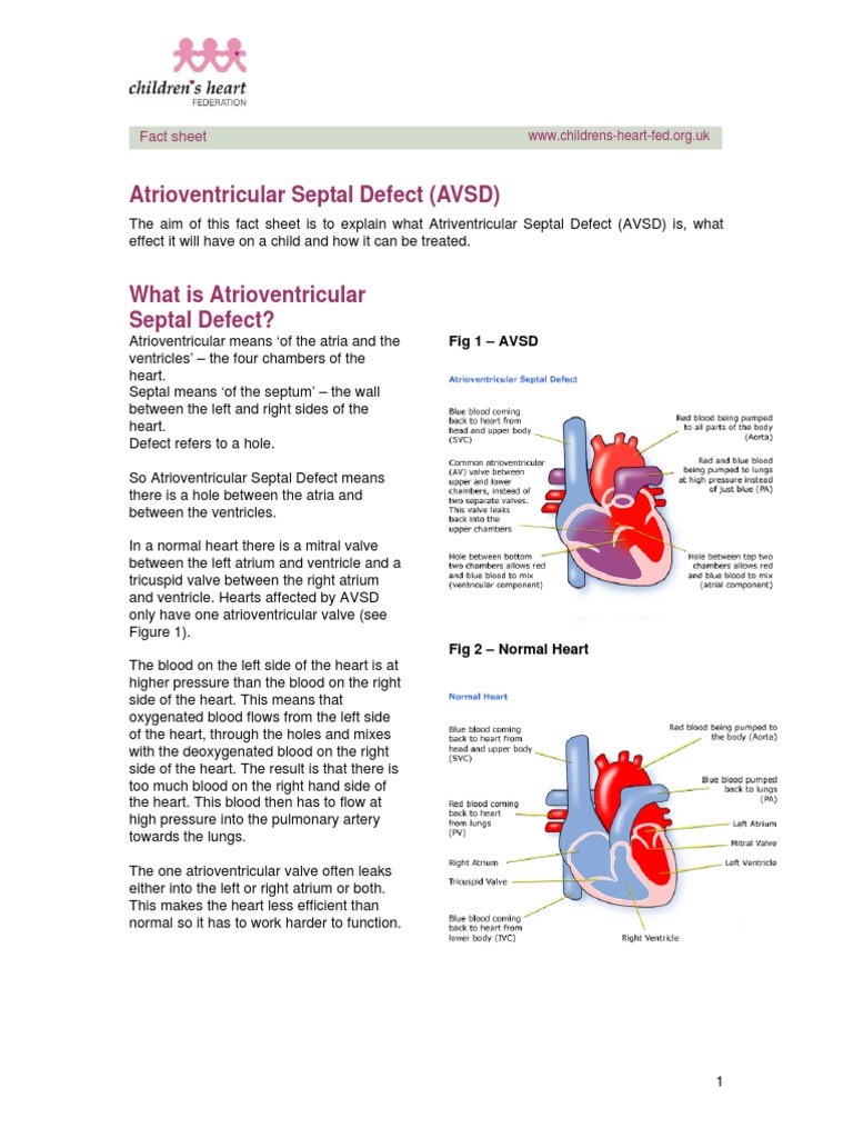 AVSD - Revised Version | PDF | Atrium (Heart) | Heart