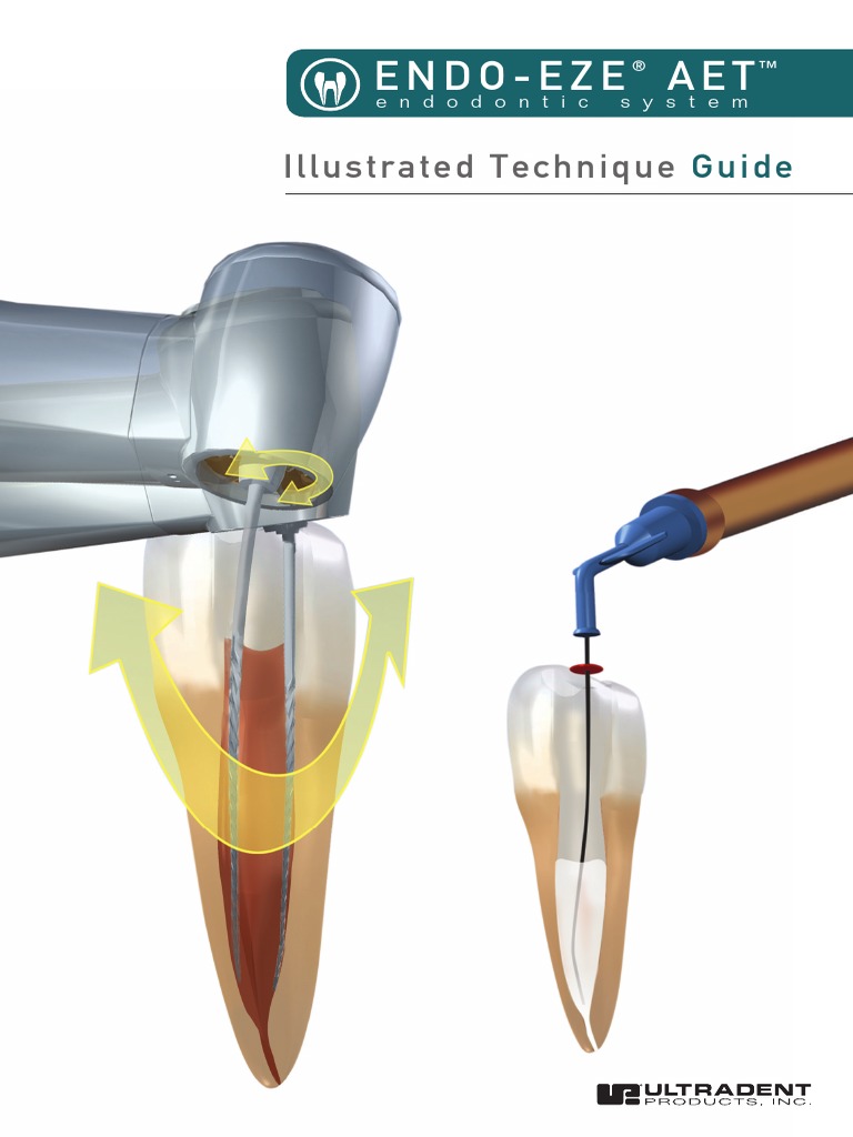 Endo-Eze AET Illustrated Technique Guide PDF | PDF ...