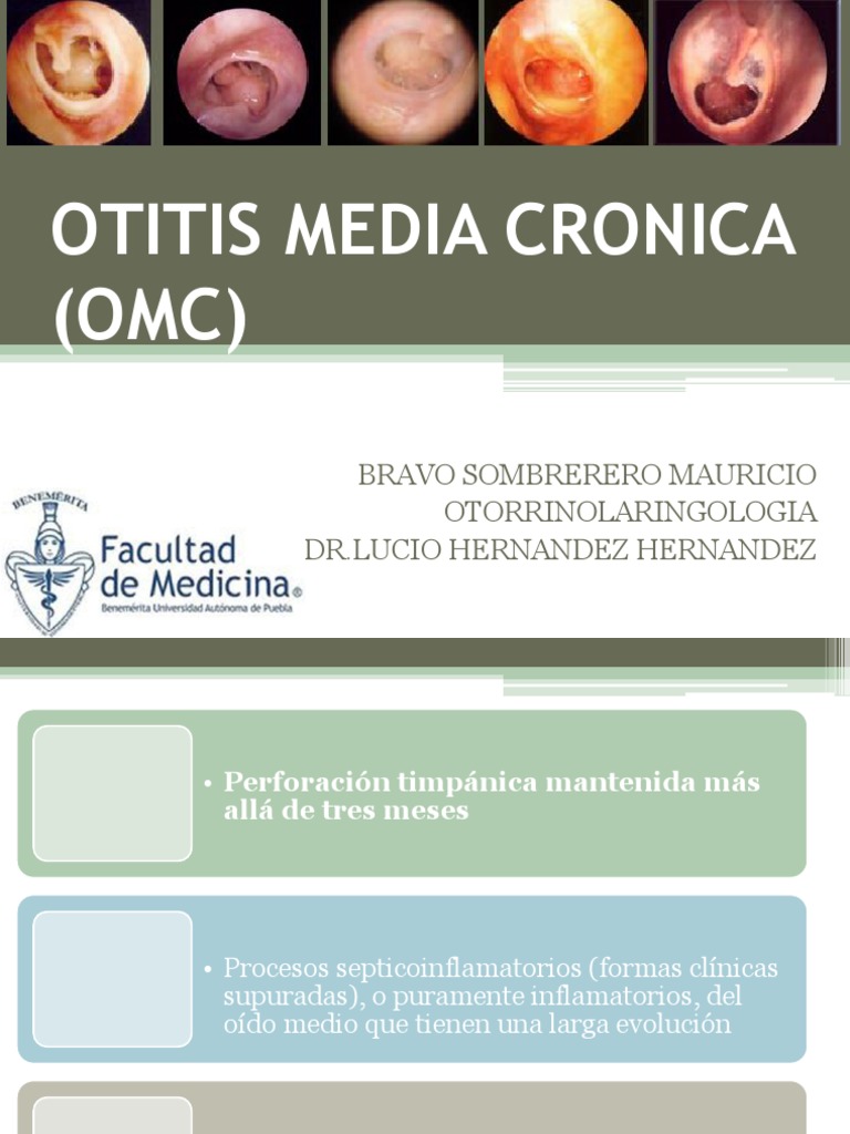Otitis Media Cronica | PDF | Oído | Cabeza y cuello humanos