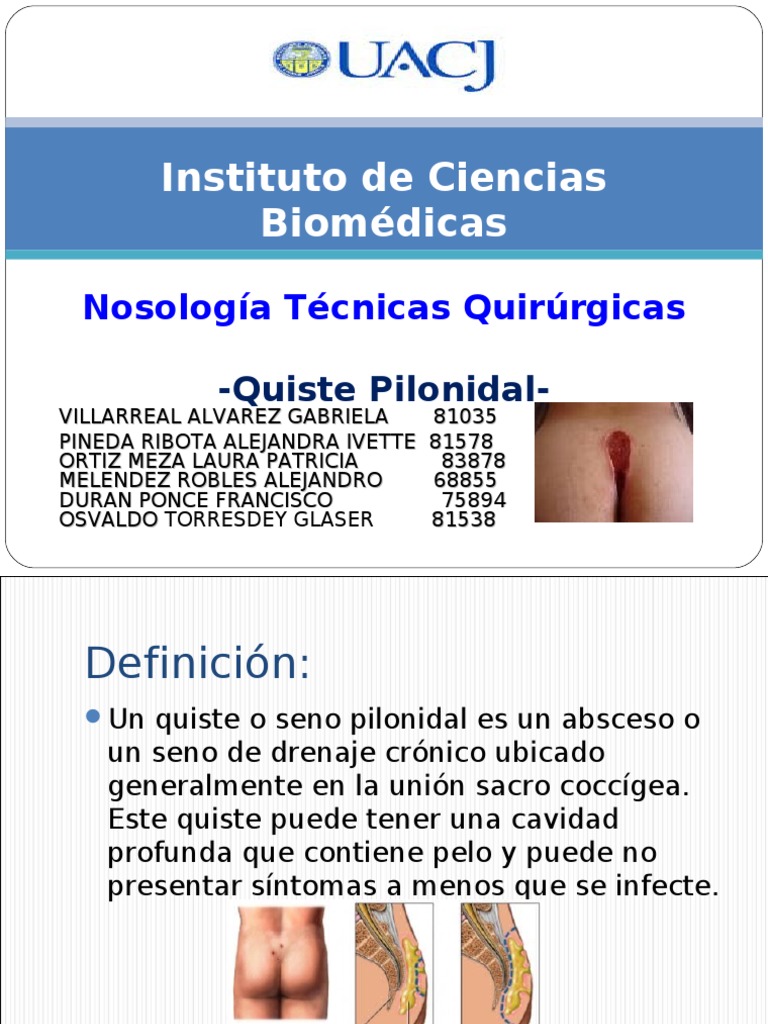 Quiste Pilonidal | PDF