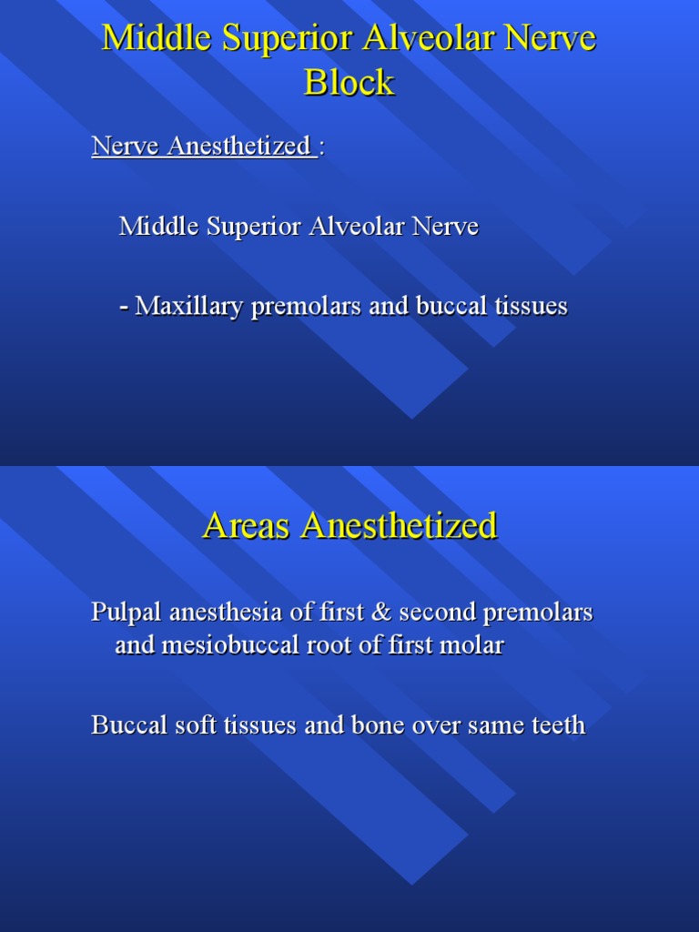 Middle Superior Alveolar Nerve Block | PDF | Human Tooth | Anesthesia