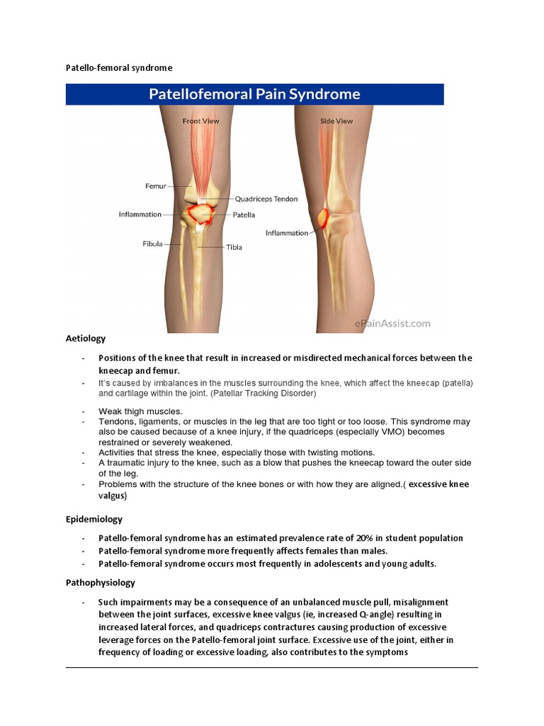 Gastrocnemius Strain | Knee | Joints