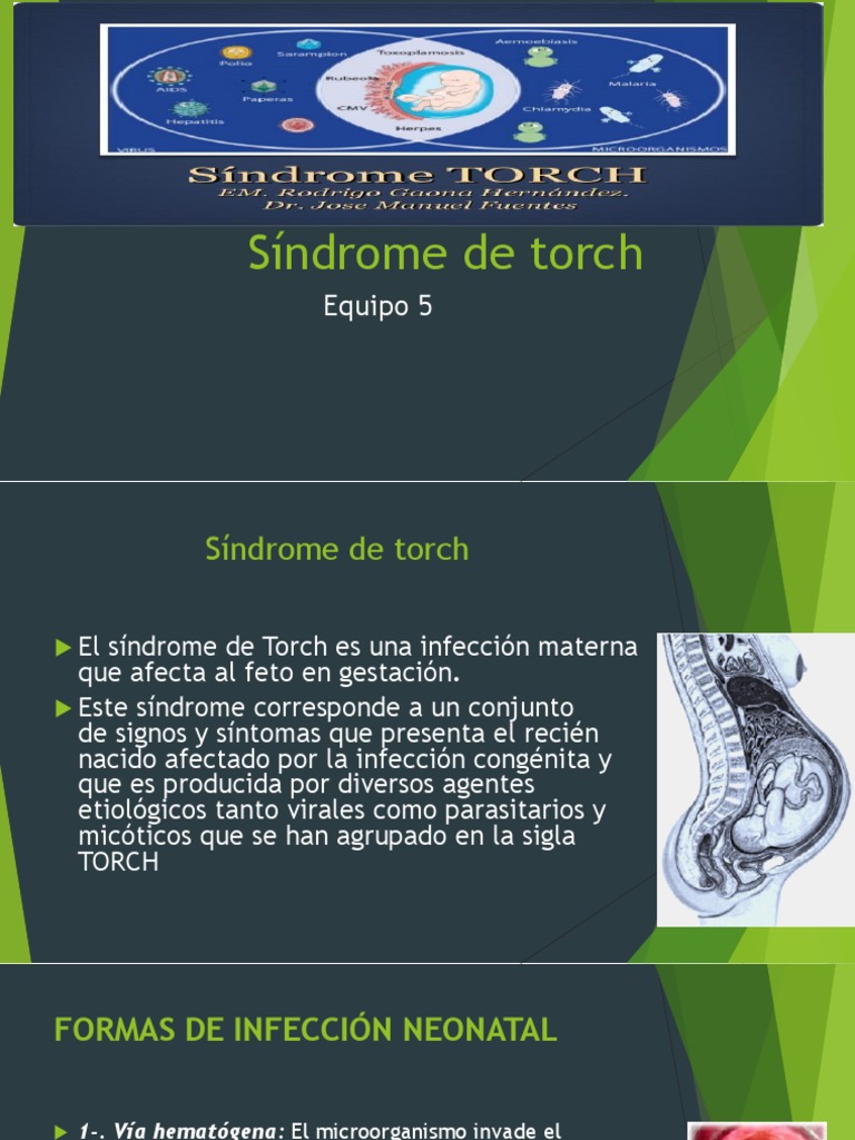 Síndrome de Torch | PDF | Ciencia y matemática