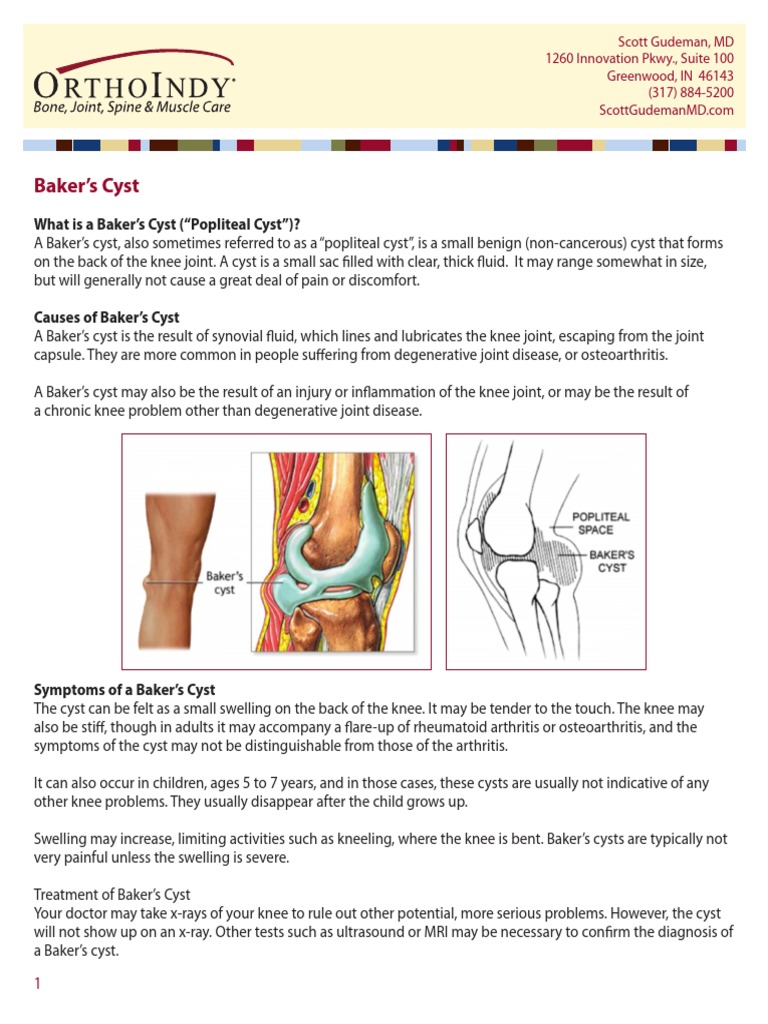 What Is A Baker's Cyst ("Popliteal Cyst") ? | PDF | Osteoarthritis | Knee