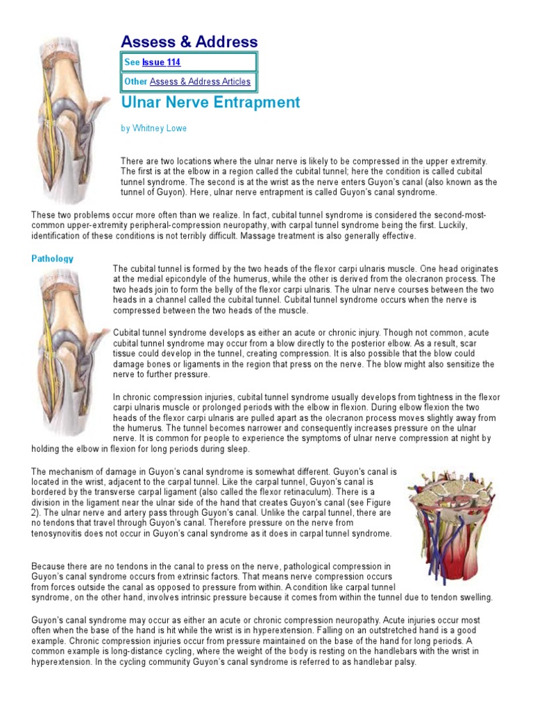 Ulnar Nerve Entrapment Massage Mag Whitney Lowe | PDF | Elbow | Hand