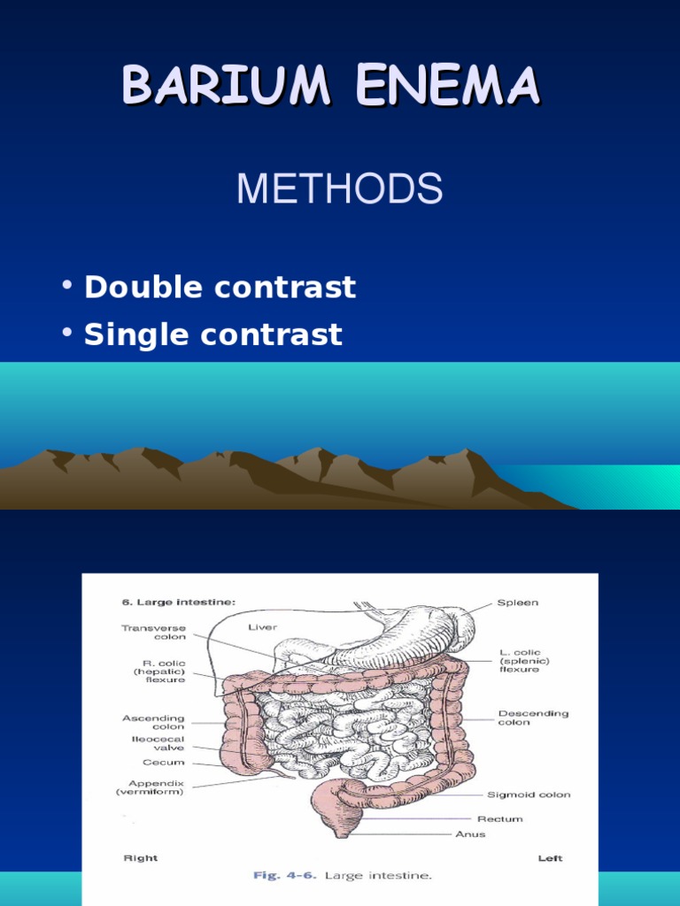 5)Barium Enema | Gastroenterology | Digestive System