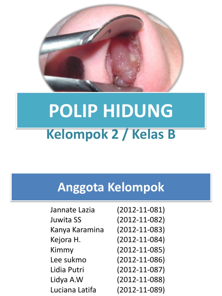 Polip Hidung - Tht- Kel2