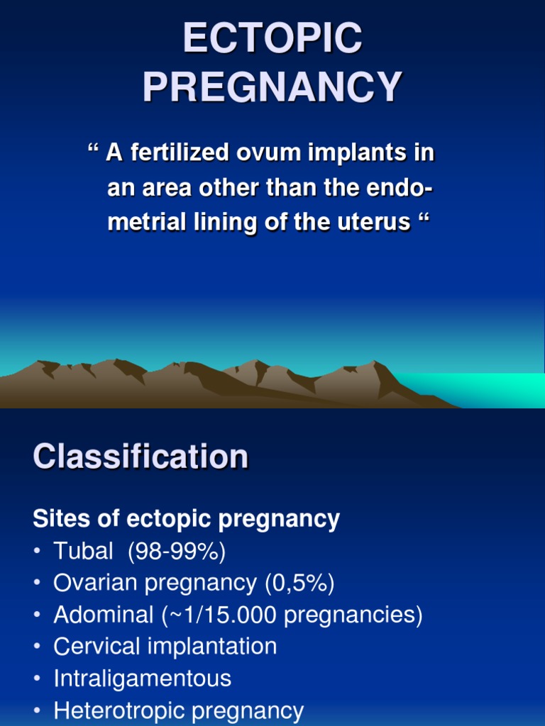 Ectopic Pregnancy Overview and Treatment | PDF