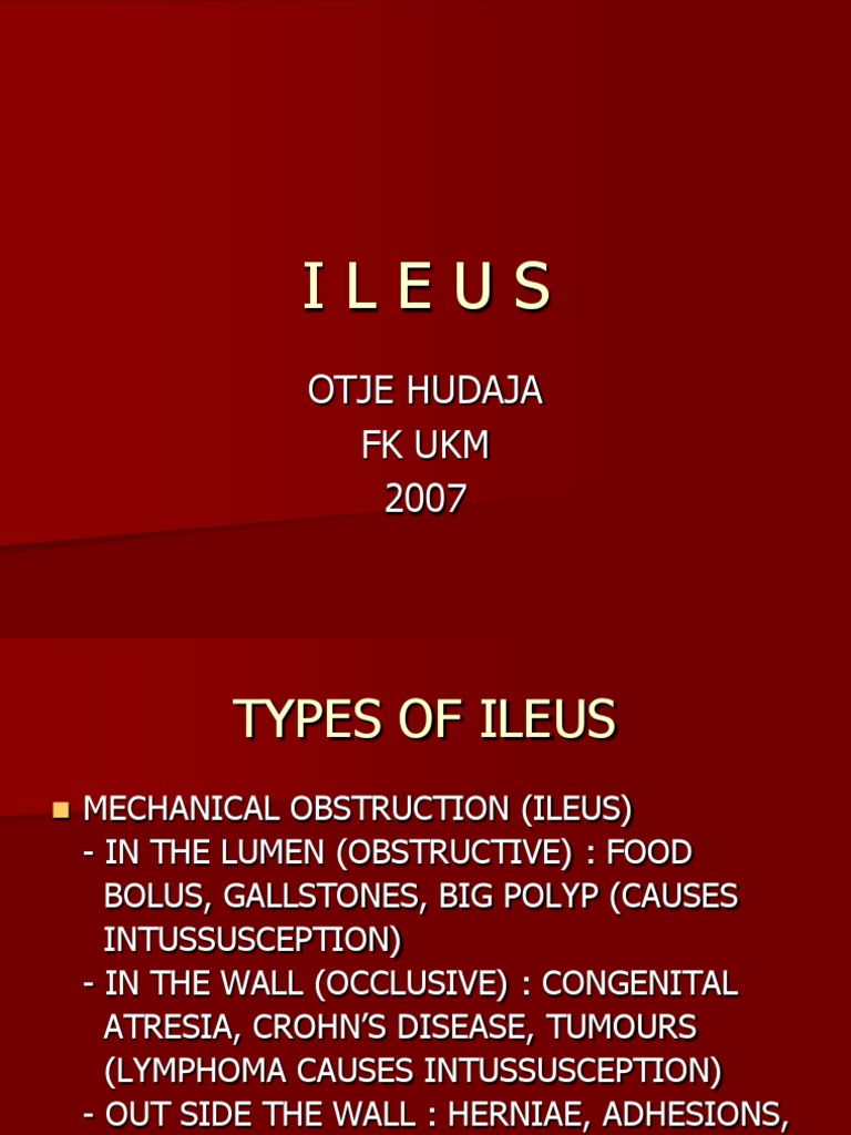 ILEUS | PDF | Gastroenterology | Diseases And Disorders