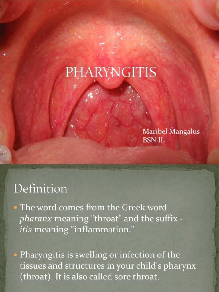 Pharyngitis Tonsilitis | PDF | Medical Specialties | Diseases And Disorders