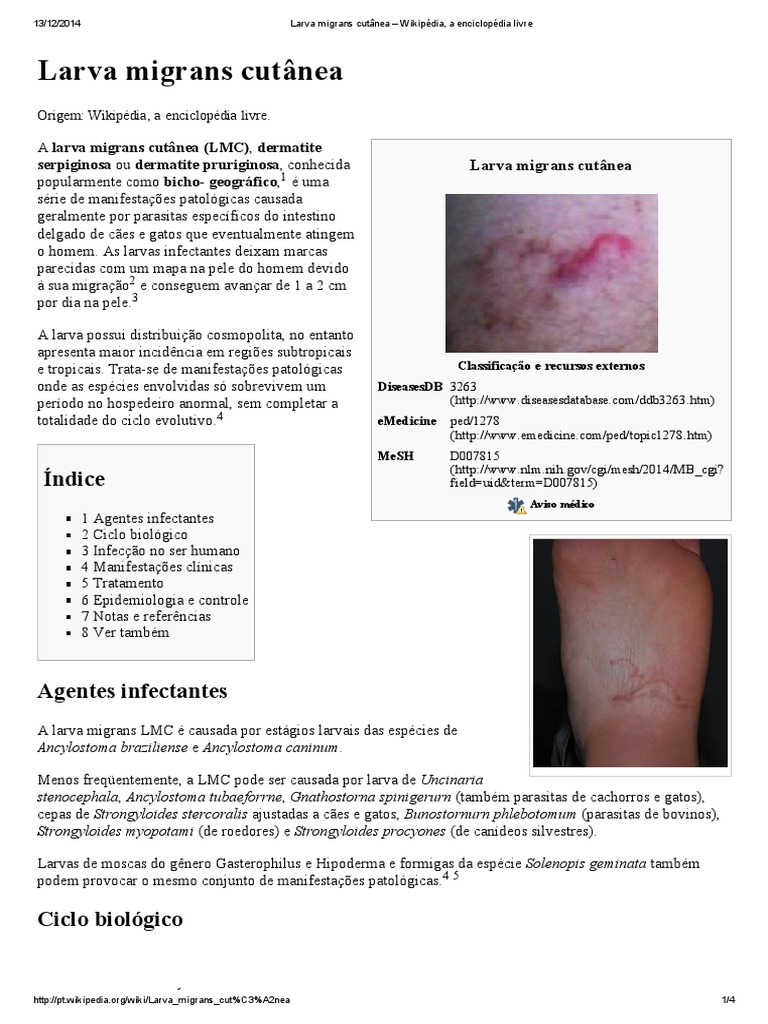 Larva Migrans Cutânea - Wikipédia, A Enciclopédia Livre | PDF ...