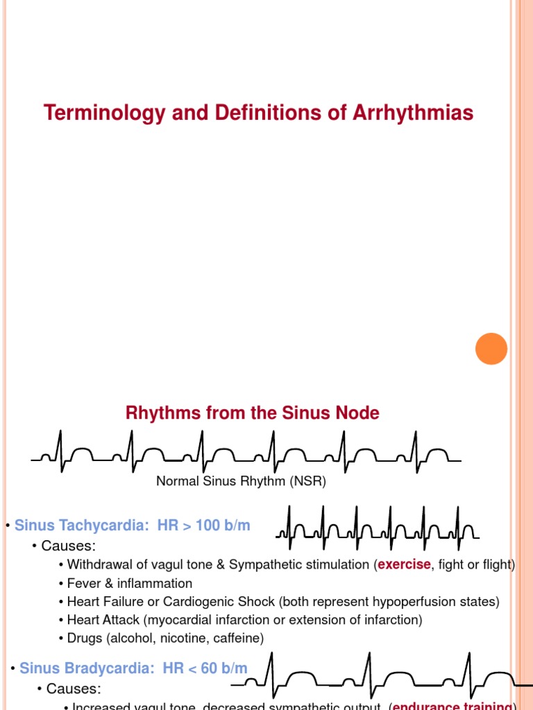 Terminology and Definitions of Arrhythmias | PDF | Cardiac Arrhythmia ...