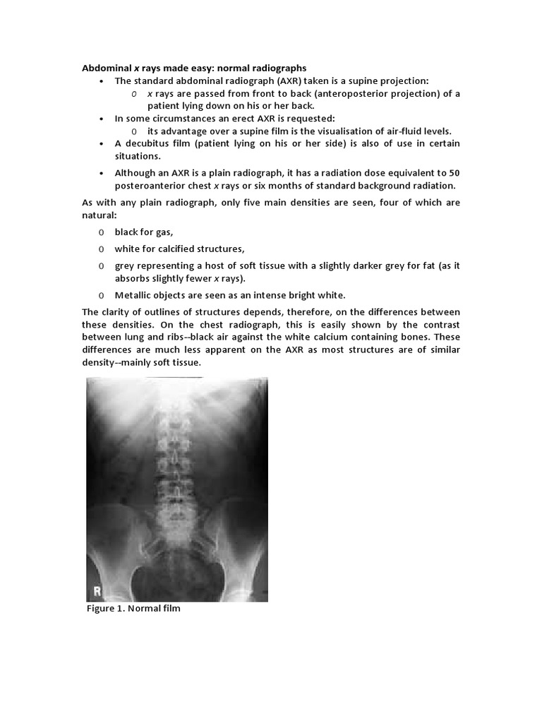 Abdominal X Rays Made Easy: Normal Radiographs: o X Rays Are Passed ...