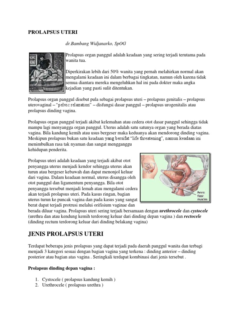 Prolapsus Uteri | PDF